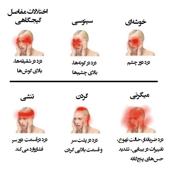انواع سردرد و چگونگی رفع آن‌ها